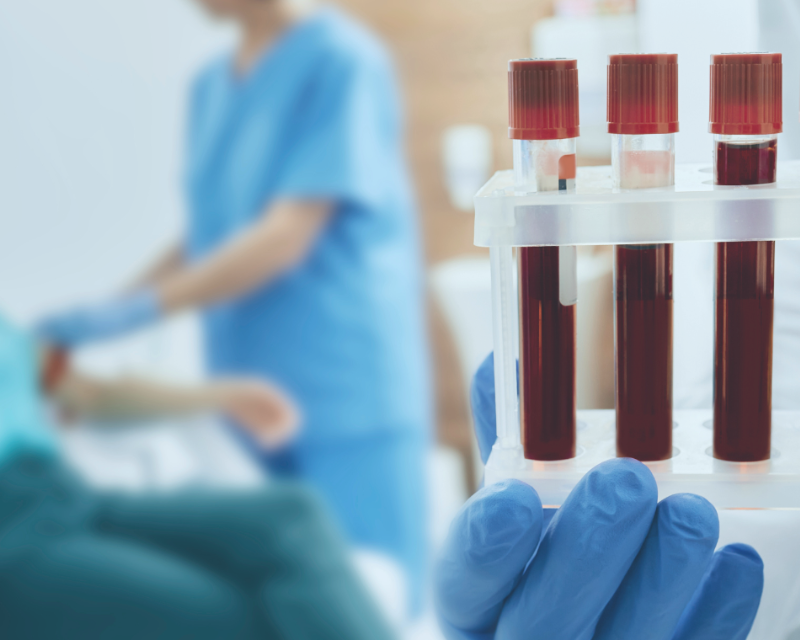 Understanding Your Lab Tests with PKD | Kidney Nutrition - PKD ...