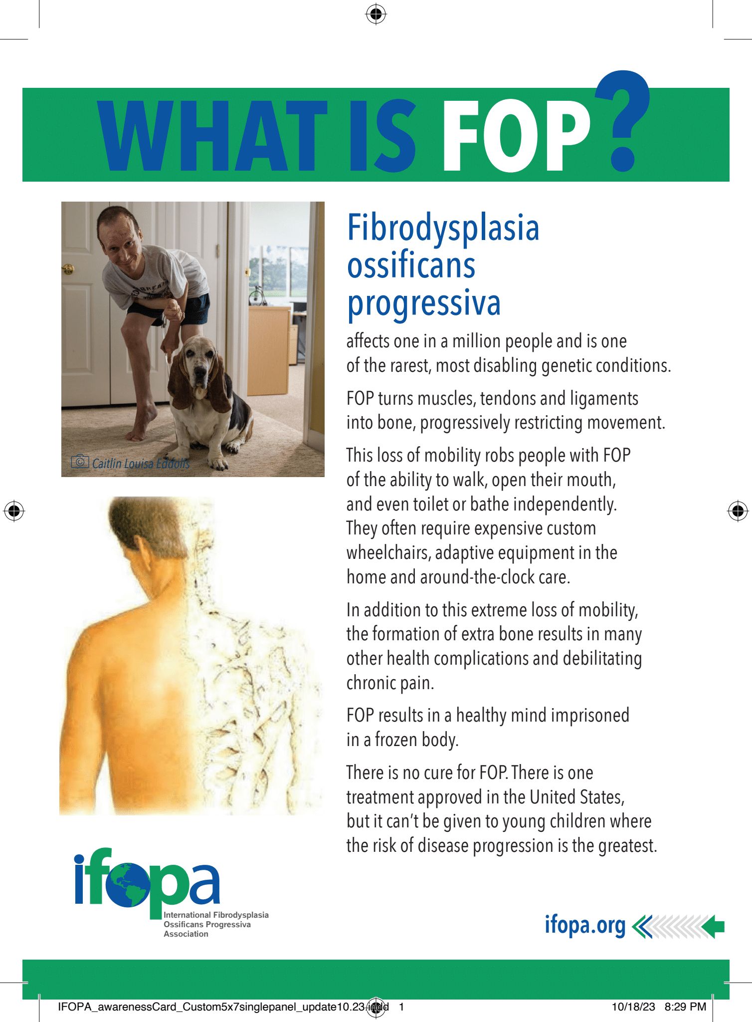 Raise Awareness - IFOPA - International Fibrodysplasia Ossificans ...