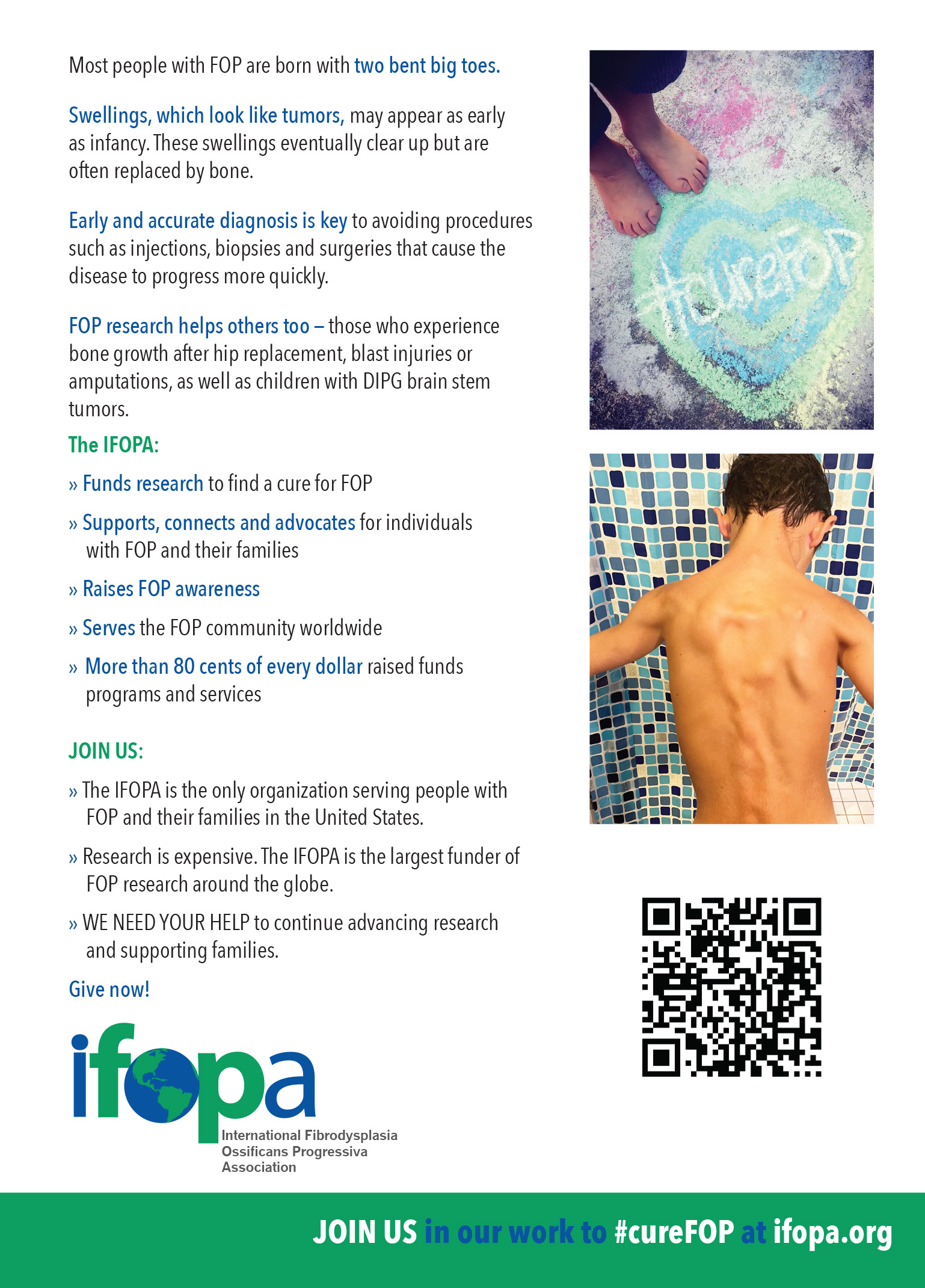 Raise Awareness - IFOPA - International Fibrodysplasia Ossificans ...