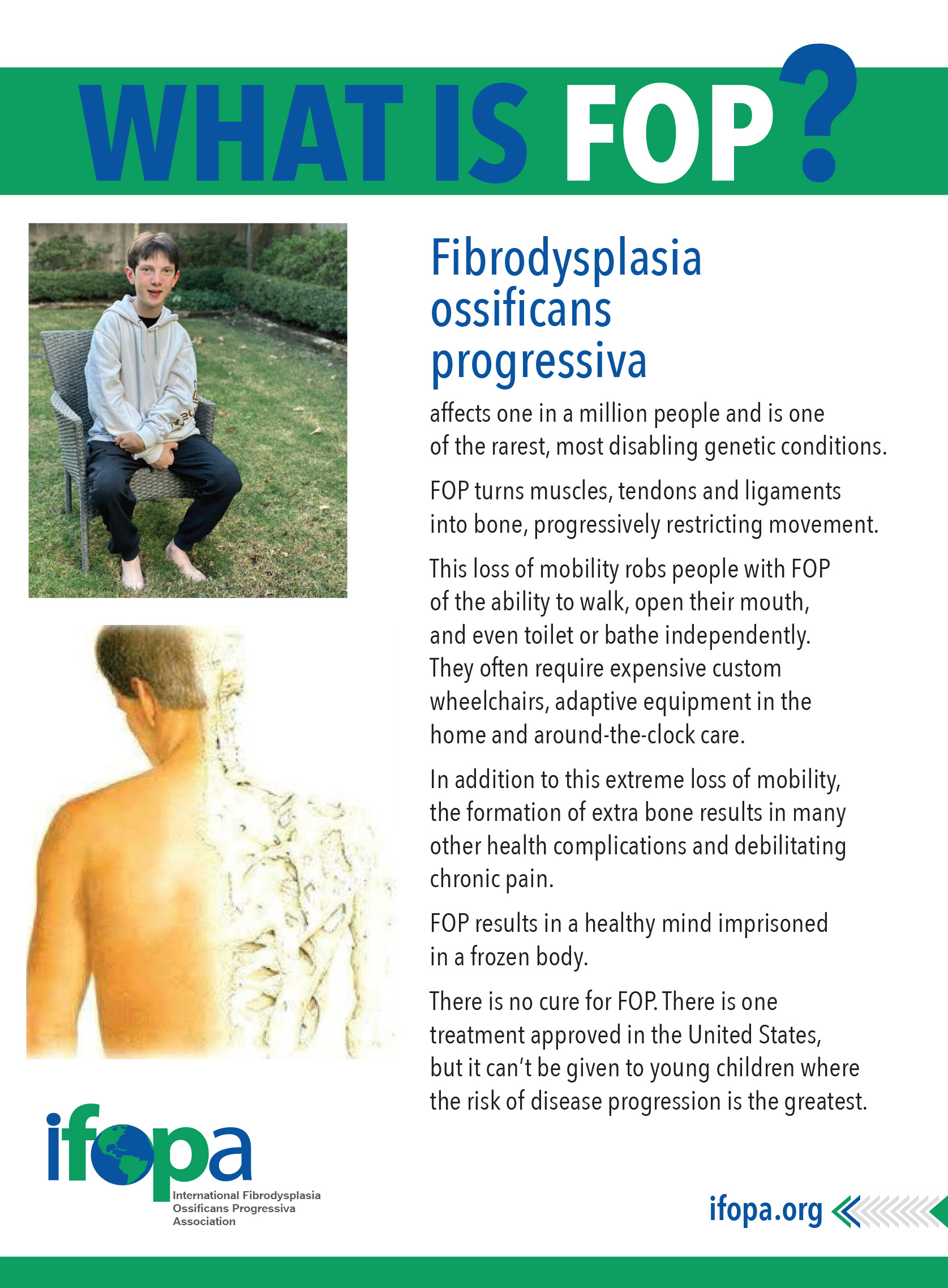 Raise Awareness - IFOPA - International Fibrodysplasia Ossificans ...