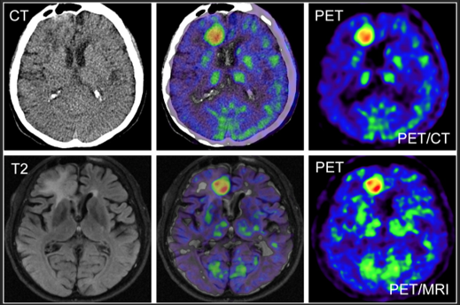 CANADA’S OHS INSURANCE BOARD FUNDS RESEARCH INTO CHRONIC PAIN - OHS Reps
